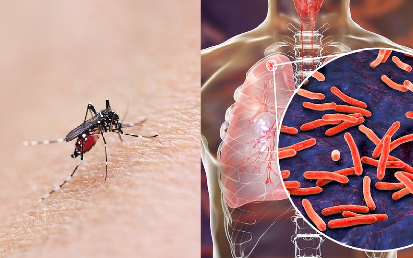 Health Crisis in Batam: Rising Dengue, Tuberculosis, and Diarrhea Cases ...